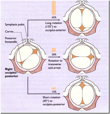 INFORMASI REPRODUKSI: DISTOSIA AKIBAT KELAINAN JANIN